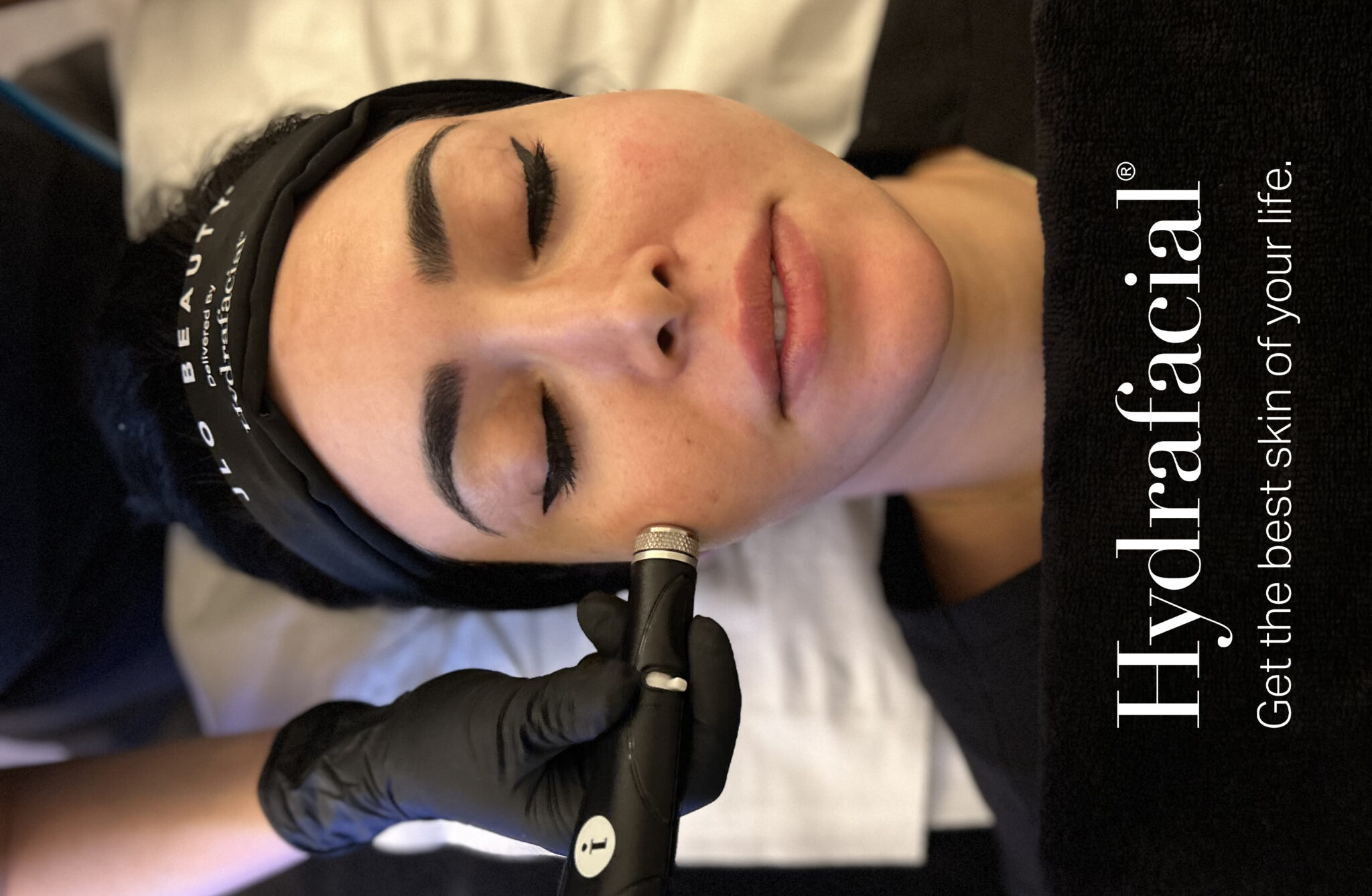 Hydrafacial | radianceaestheticclinic.com